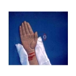 Self Inflicted Wounds on Forearm Model Manufacturers, Supplier ...